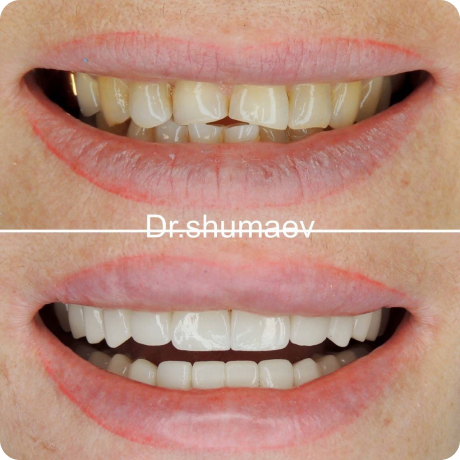 Dr.Shumaev - Digital Smile Design
